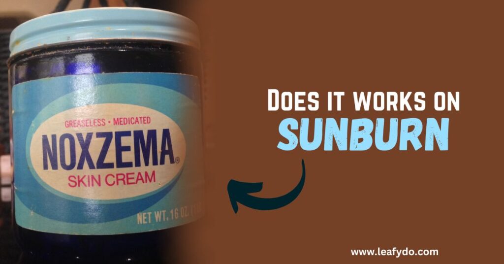 Does Noxzema Help Sunburn